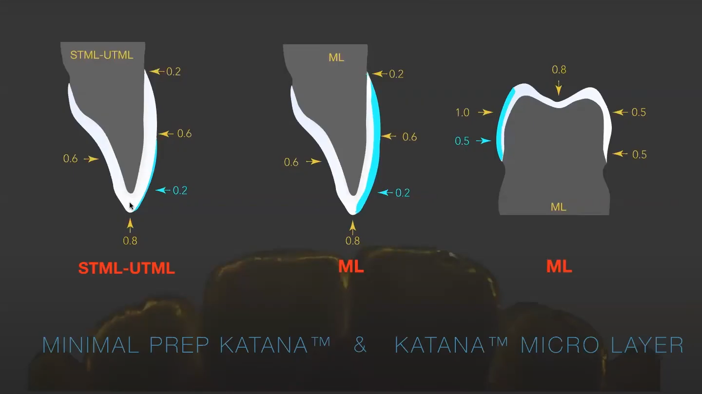 [EU] On Demand Webinar - Dr Davide Cortellini on The Winning Triad ...